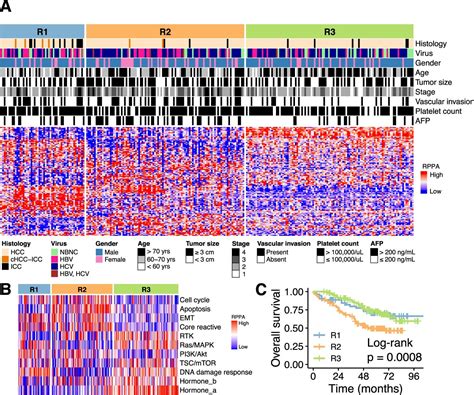 Large Scale Proteo Genomic Profiling Of Virus Associated Liver Cancer Unveils Potential Subtypes