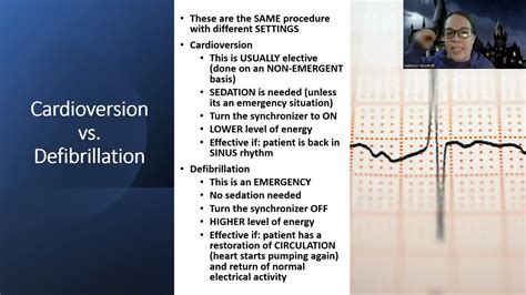 Adult Med Surg Dysrhythmia New Lecture Defibrillation Vs Cardioversion Youtube