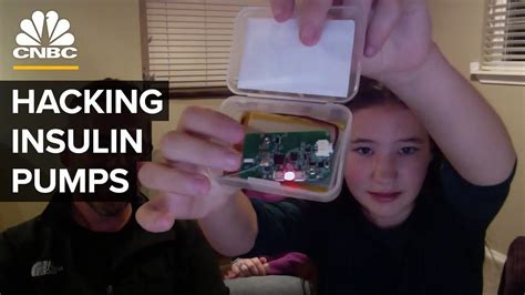 Diabetics Are Hacking Their Own Insulin Pumps