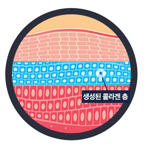 캐번리프팅 Lebon8655