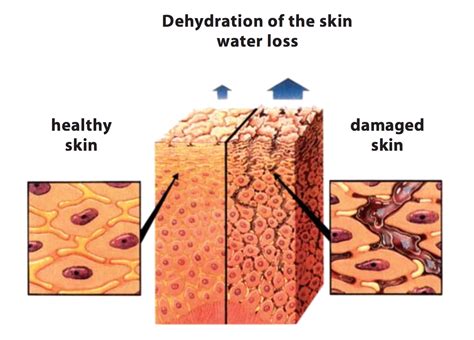 Skin Function — Pr 88 Industrial Skin Care