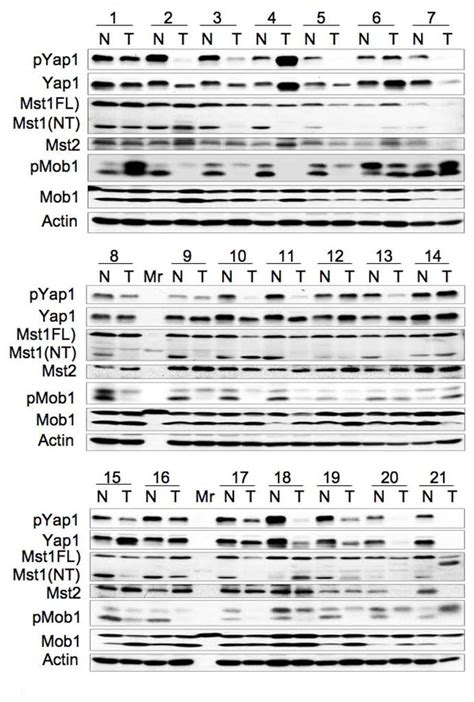 Mst1 And Mst2 Maintain Hepatocyte Quiescence And Suppress The