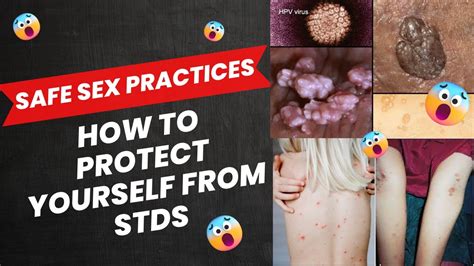 Safe Sex Practices How To Protect Yourself From Stds Youtube