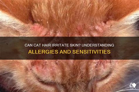 Can Cat Hair Irritate Skin Understanding Allergies And Sensitivities