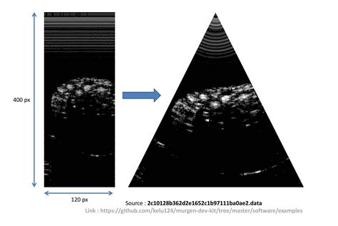 How To Convert Scan Lines In Polar Coordinates To A B Mode Ultrasound