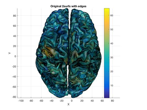 Demo Fmri Surface Based Searchlights With Lda Classifier