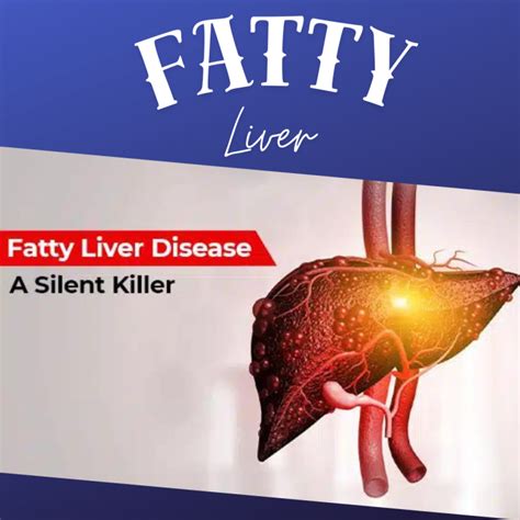 Омазнен черен дроб Как съвременния начин на хранене разрушава нашето здраве