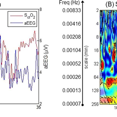 Wavelet Based S Ct O 2 Aeeg Coherence Showing Low Neurovascular