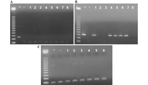 Ghrh Ligand And Receptor Expressions In Gb Samples Representative Gel