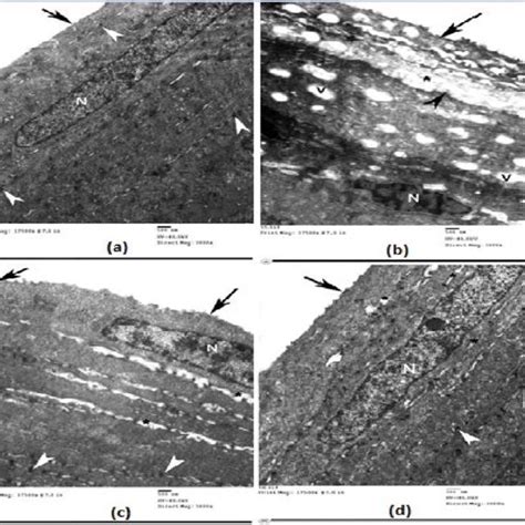 A Electron Micrograph Of Exosome Showing Spheroid Appearance Black