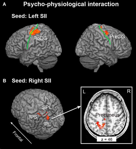 Secondary Somatosensory Cortex