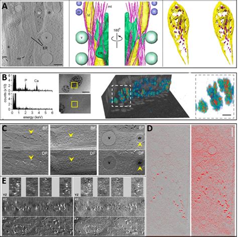 Whole Cell Cstet Of Fibroblast Cells A Slice And Segmentation