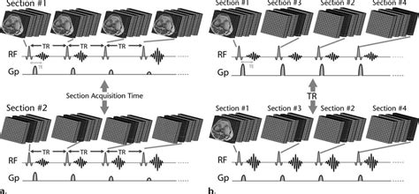 A Drawings Illustrate Single Section Technique In Which All