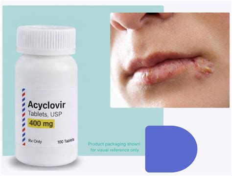 Acyclovir Prescription Online Miiskin