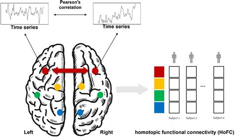 The Human Brain Is A Complicated System Built On Units