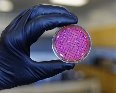 Its A Small World Three Microbiology Images Coliforms An Flickr