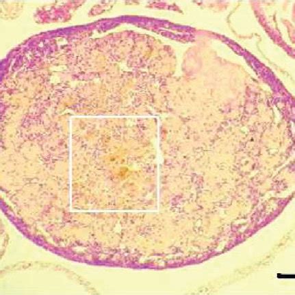 Hemosiderin In The Aged C56bl6 Ovary He Stain A B And Perls Stain