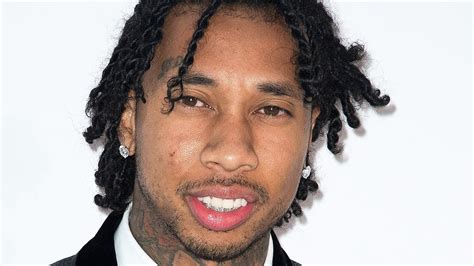 Tyga Before And After