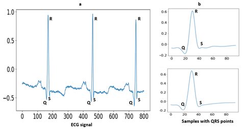 Hybrid Deep Learning And Discrete Wavelet Transform Based Ecg Biometric Recognition For