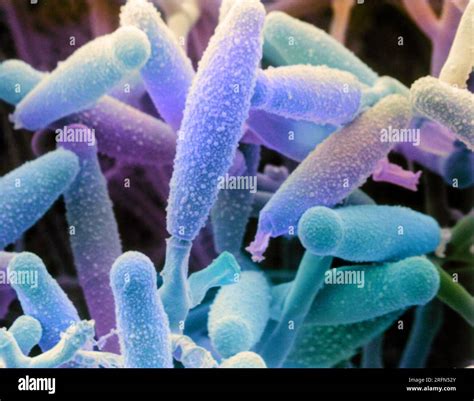 Scanning Electron Micrograph Sem Of Microsporum Gyseum Microsporum Gyseum Is A Fungus That