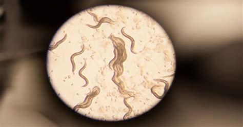 Earthworm Under Microscope