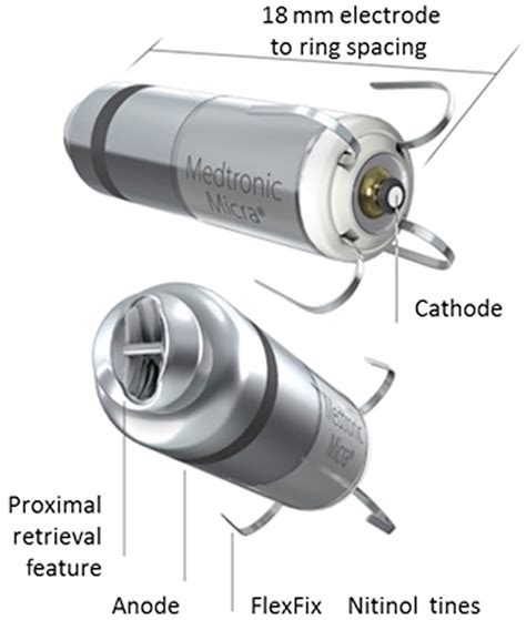 Leadless Pacemakers In Patients With Congenital Heart Disease Cardiac