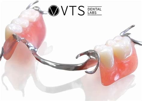 Chrome Cobalt Dentures Durable And Aesthetic Solution Vts Dental Laboratories