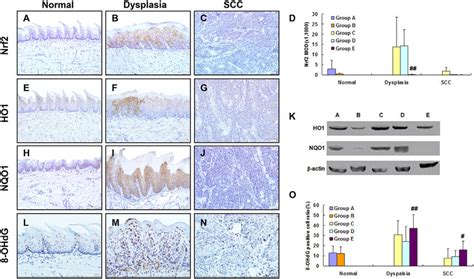 Expression Of Nrf2 Ho1 Nqo1 And 8ohdg In 4nqosfn Treated Mouse