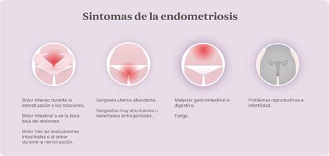 Endometriose O Que É Sintomas E Como Diagnosticar Ingl