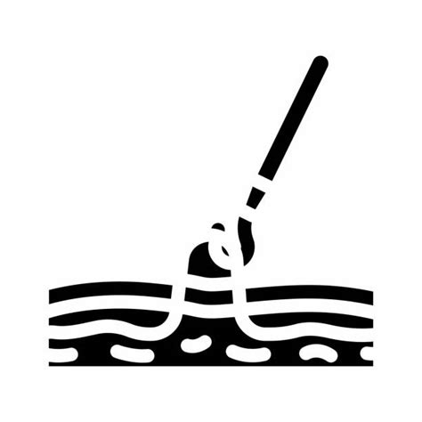 20 Phlebectomy Procedure Stock Illustrations Royalty Free Vector Graphics And Clip Art Istock