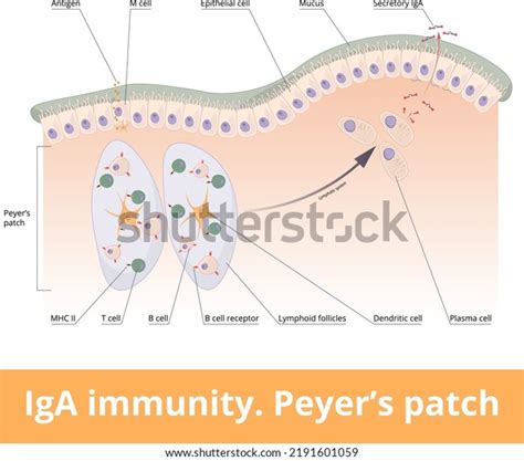 Iga Immunity Patch Lymphoid Follicles Small Stock Vector Royalty Free 2191601059 Shutterstock