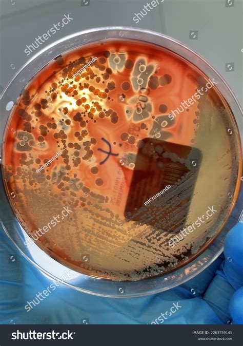 Streptococcus Agalactiae