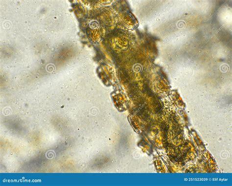 Filamentous Algae Under Microscopic View Stock Image Image Of Microbe Ocean 251523039