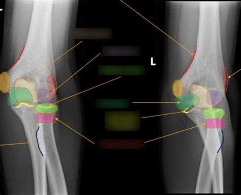 Elbow Anatomy 1 Diagram Quizlet
