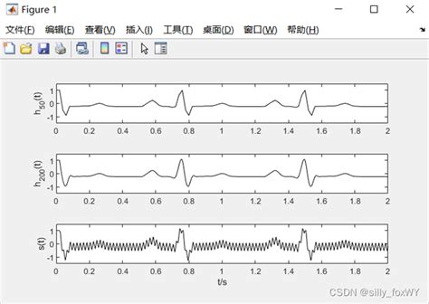心电图信号的滤波 数字信号处理实验4 可视化12导联心电图数据并用滤波器过滤 Csdn博客