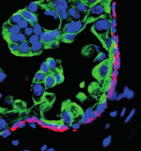 Mircury Lna Mirna Detection Probes