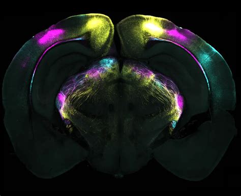 How Can The Brain Overcome Fear New Study Of Mice Offers Clues To Ptsd
