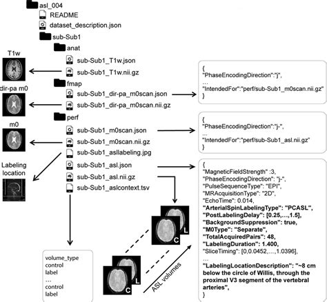 Illustrates The Asl Bids Example Dataset Asl 004²⁹ Which Is A