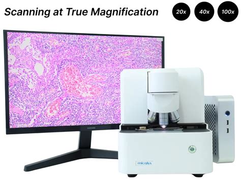 Micalys Whole Slide Scanner At Best Price In Thane By Medprime