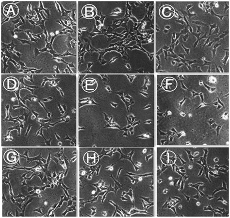Representative Images Showing Podocyte Morphology In The Control Group
