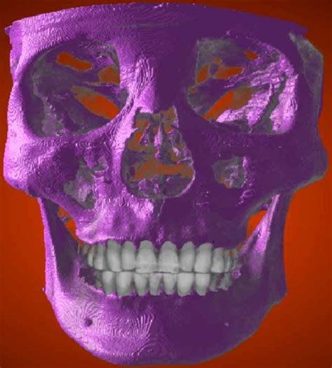 Result After The Semantic Segmentation In The Picture The Pink Data