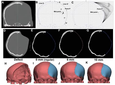Three Dimensional 3d Computer Assisted Design Cad Model For Skull