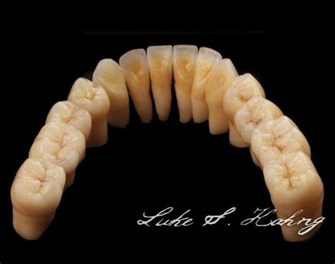 The Y 5 Molar Morphology Is Present In