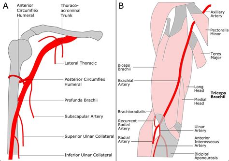 Radial Artery Access Anatomy Considerations For Neuroendovascular