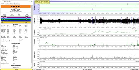 How Can I Fix Flow Limitation When Epr Is Maxed Out R Cpap