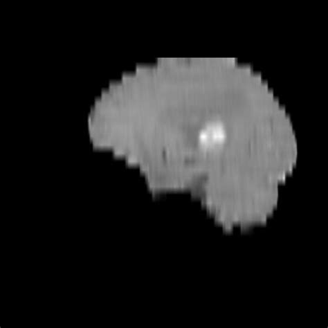 Mmenendezg Brain Tumor Object Detection Datasets At Hugging Face