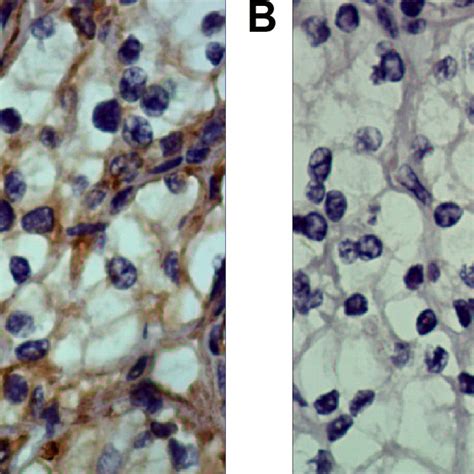 Vegfa Protein Expression Notes Vegfa Protein Positively Expressed In