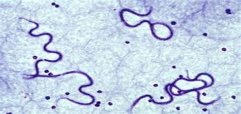 Nematodes Circulatory Respiratory Urinary Eye Skin Flashcards Quizlet