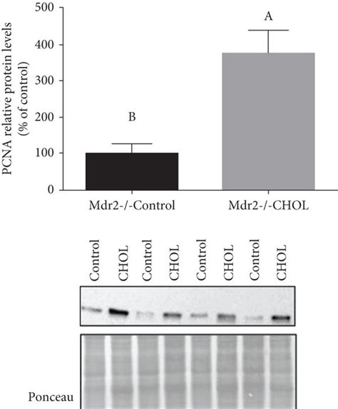 Proliferative Effects Of Cholesterol In Liver Tissue A Ihc Staining