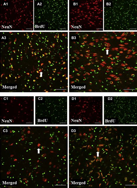Granulocyte Colony Stimulating Factor G Csf Therapy Restored Download Scientific Diagram